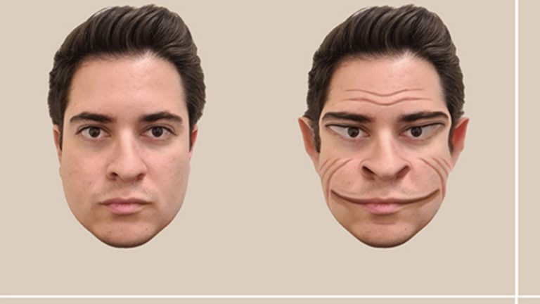 'Síndrome da face demoníaca': o que se sabe sobre a doença?